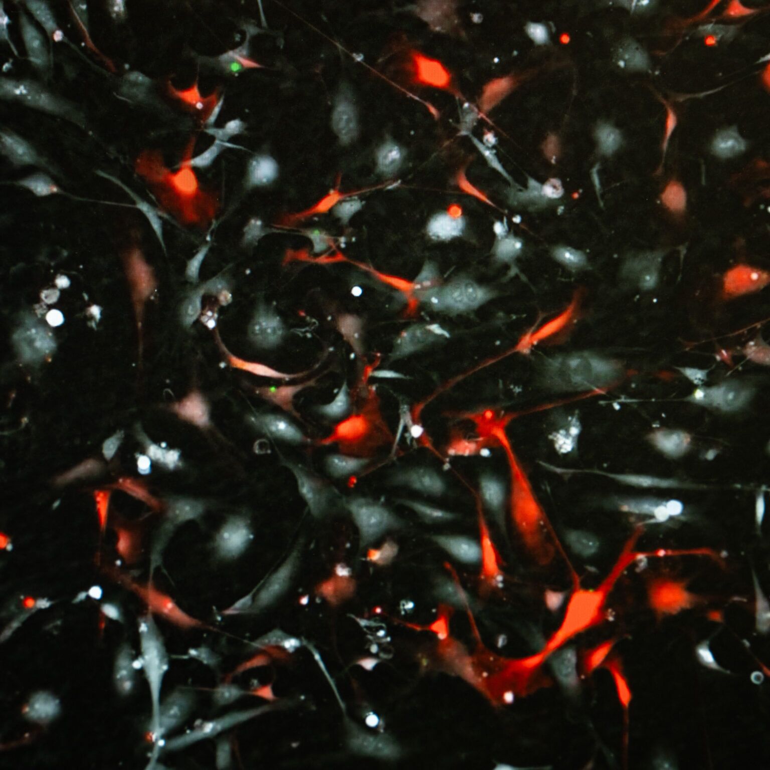 World-first clinical trial for treating spinal cord injury - Griffith News