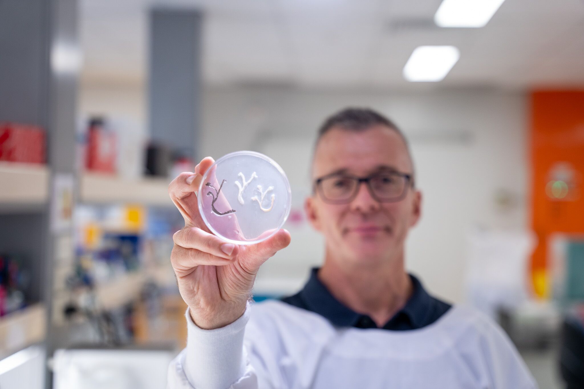 World-first clinical trial for treating spinal cord injury - Griffith News